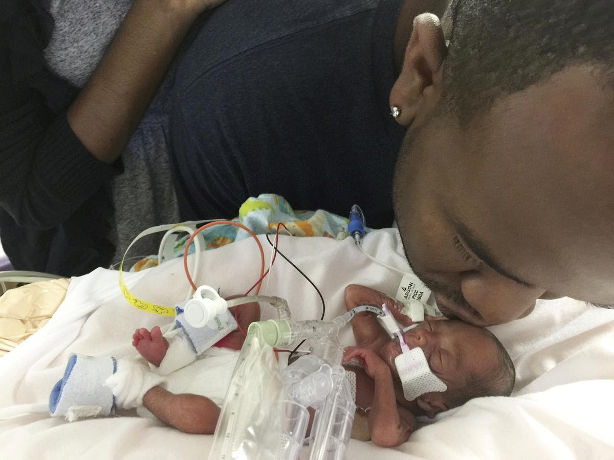 Baby born at 22 weeks, now thriving at 8 years old - Cincinnati Right ...